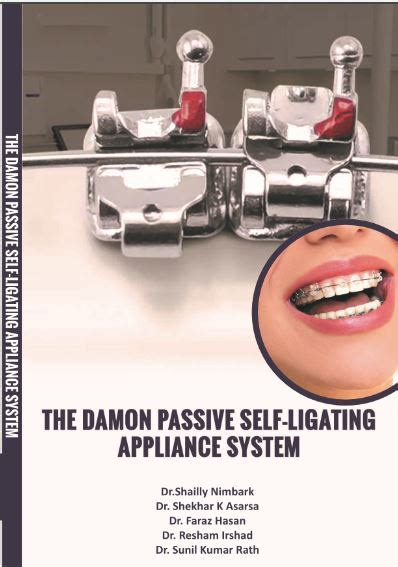 The Damon Passive Self Ligating Appliance System Online Book Stores
