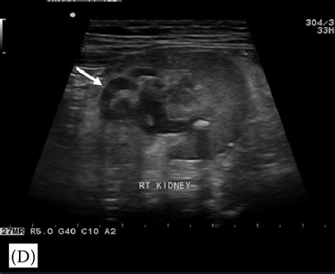 Abdominal Ultrasound Findings In A Cat With Recurrent Hydronephrosis