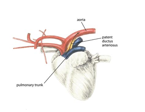 Imagepatent Ductus Arteriosus Merck Veterinary Manual