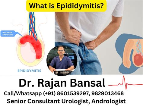 What Is Epididymitis A Complete Guide