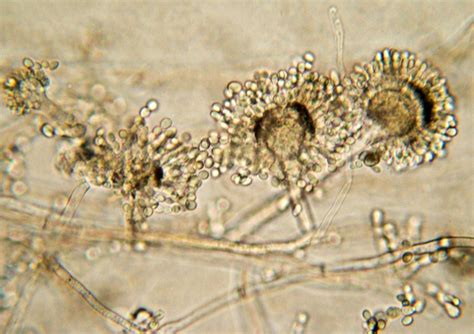 Aspergillus Under Microscope