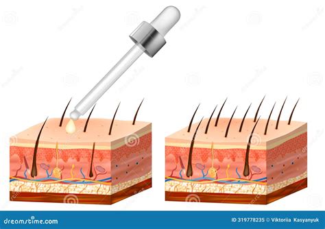 Treatment Alopecia Color Line Illustration 277998970