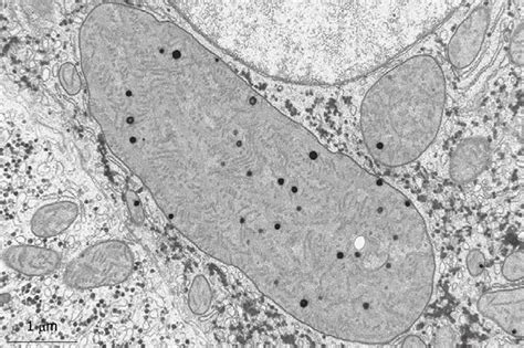 Fixation For Electron Microscopy At Geri Hodge Blog