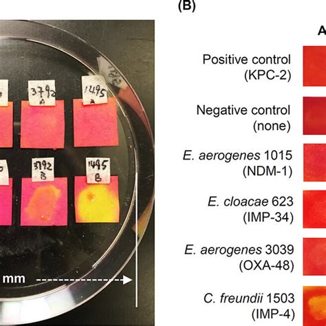 Pdf Rapid Detection Of Carbapenemase Production In Enterobacteriaceae Using A Modified Paper