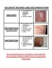 Understanding Wound Care Terminology Excoriation Vs Maceration