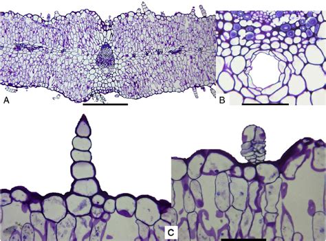 Pteronia Divaricata Transverse Sections Of A Leaf Showing A Secretory Download Scientific