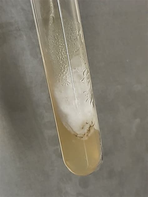 Clinical Microbiology Mold Identification Archives Medical Notes