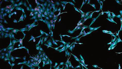 Stemrna™ Clinical Ipsc For Your Clinical Project In Compliance With