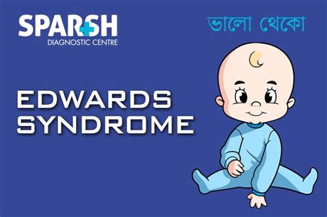 Edwards Syndrome Trisomy 18 Sparsh Diagnostic Center