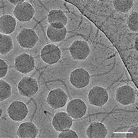 バクテリオファージ Dt57c の電子顕微鏡写真 沖縄科学技術大学院大学（oist）