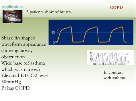 09 Pre Hospital Capnography