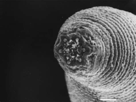 Pinworm Under Microscope