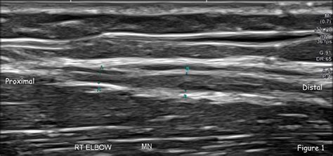 Annals Of Plastic Surgery