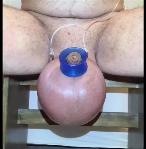 Die Vorhaut Füllen Mit Saline Bis Zum Orgasmus Xhamster