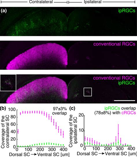 The Projections Of Iprgcs And Conventional Rgcs To Retinorecipient Brain Nuclei Pmc