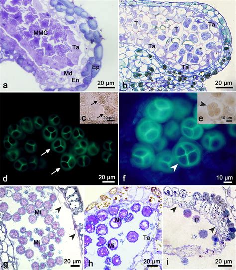 Developmental Events During Pollen Development In G Celebica Anther A