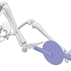 SimTK SimVascular Examples And Clinical Cases Project Home