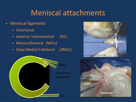 Ppt Meniscal And Anterior Cruciate Ligament Injuries Powerpoint