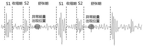 physiological parameter acquisition method and device and physiological parameter processing