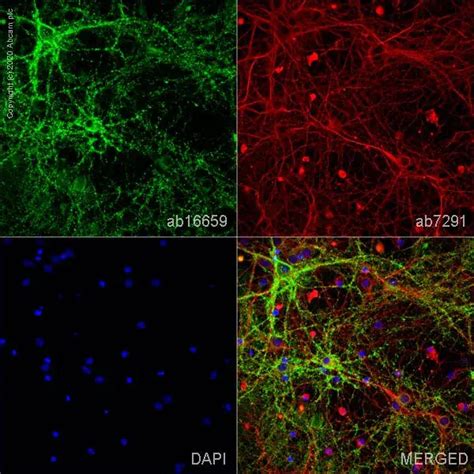 Synaptophysin抗体 Sp11 Synaptic Marker Ab16659 Abcam中文官网