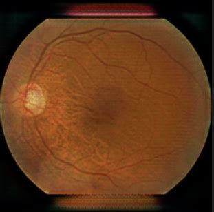 Dataset Did You Use All The Eyeq Data Issue Qtacierp Isecret Github