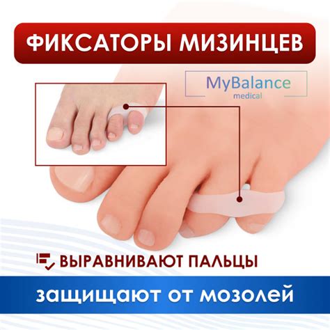 Фиксатор мизинца стопы MyBalance с межпальцевым разделителем - купить с ...