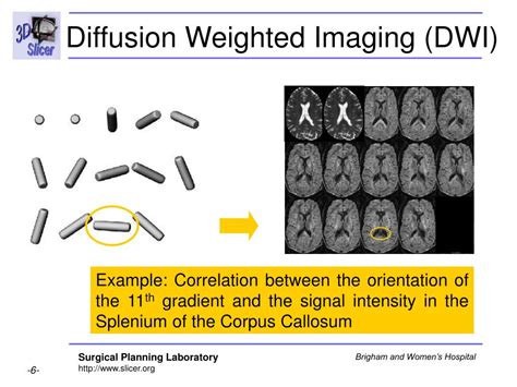 Ppt Diffusion Tensor Imaging From Dicom To Nrrd Powerpoint Presentation Id4462032