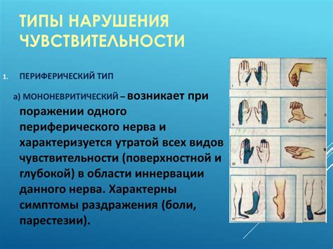 Чувствительная система Синдромы поражения Online Presentation