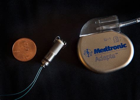 Comprehensive Guide To Implantable Cardiac Pacemakers Media Center