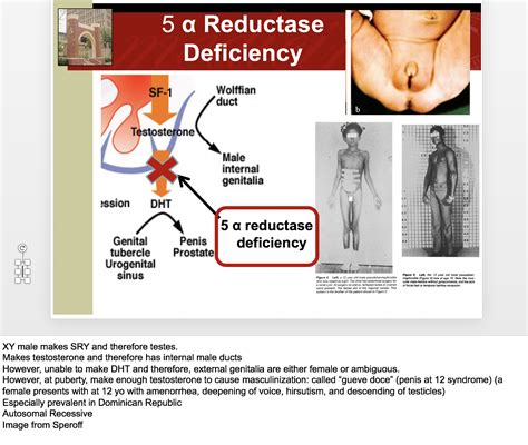 Ambiguous Genitalia Diagram