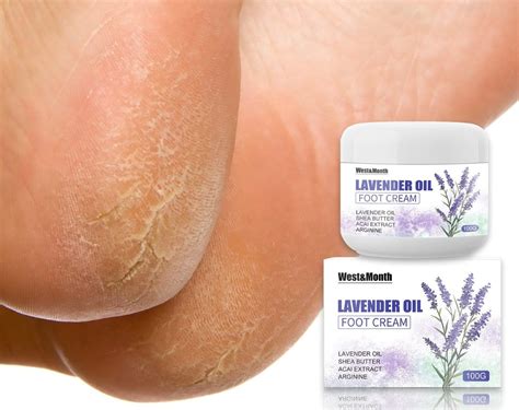 קרם לבנדר לטיפול ומניעת יובש בכפות הרגליים Sale Fix