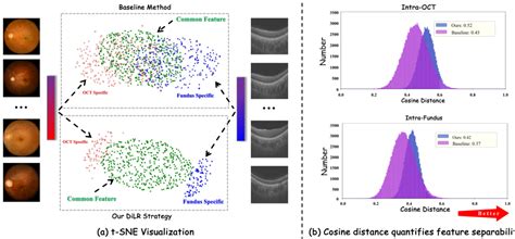 [논문 리뷰] Robust Multimodal Learning For Ophthalmic Disease Grading Via Disentangled Representation