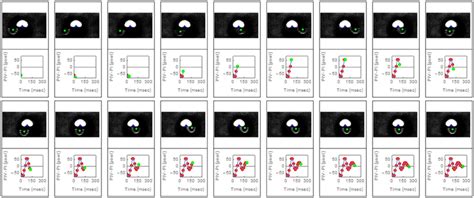 Frame By Frame Sequence Of A 9° Saccade Movement The Sequence