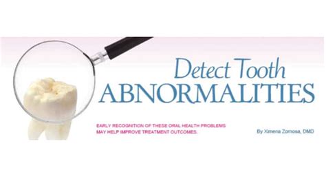 Detect Tooth Abnormalities Dimensions Of Dental Hygiene