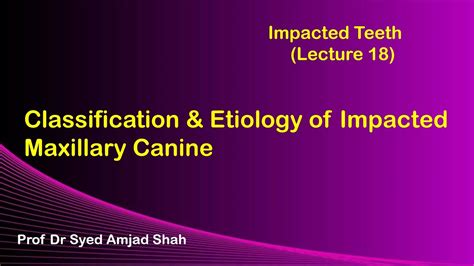 Classification And Etiology Of Impacted Canine Oral And Maxillofacial