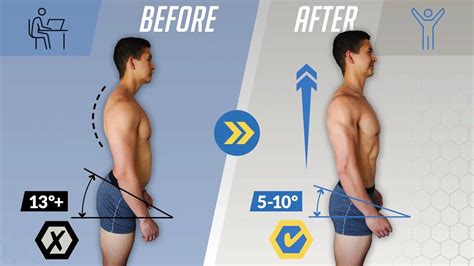 Fix Anterior Pelvic Tilt In 10 Minutes Day Daily Exercise Routine