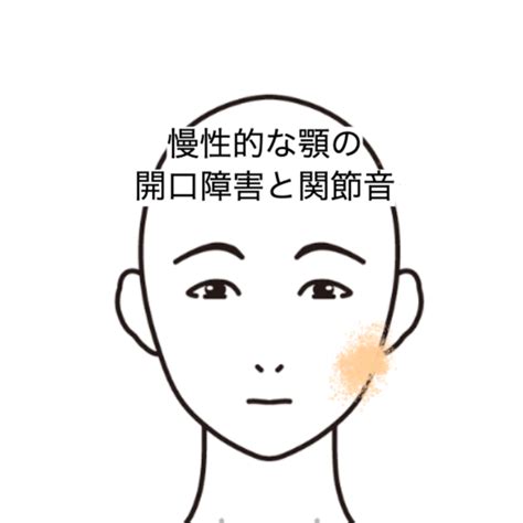 慢性的な顎の開口障害と関節音｜顎関節症のツボ｜ツボネット 鍼灸の症例が検索できるツボ辞典
