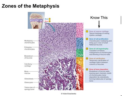 Lesson 9 Chapter 7 Bone Osseous Tissues Flashcards Quizlet