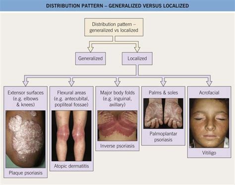 Basic Principles Of Dermatology Clinical Gateclinical Gate