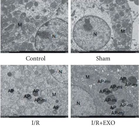 Bmsc Derived Evs Promoted Mitophagy And Attenuated Inflammasome