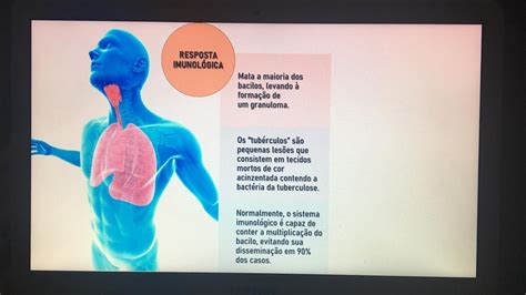 Tuberculose Slide Set