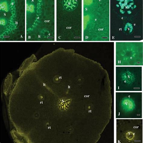 A I Selaginella Borealis A Stem Polystele With Two Meristeles