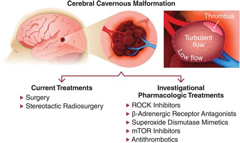 Cerebral Cavernous Malformations A Comprehensive Overview Dr Prem Pillay