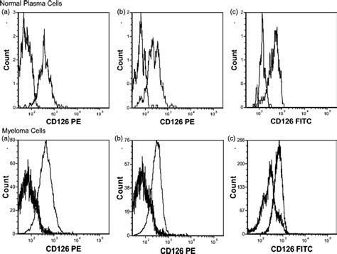 Staining Of Normal Plasma Cells Npcs And Abnormal Plasma Cells Apcs