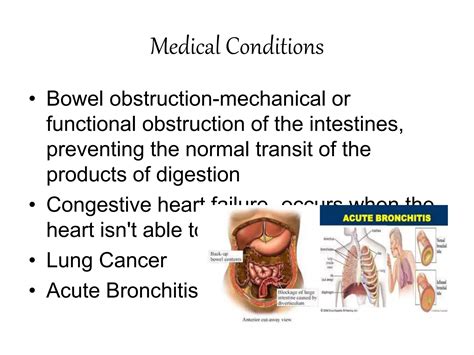 Basic First Aid Bleeding Pptx Basic First Aid Bleeding Pptx