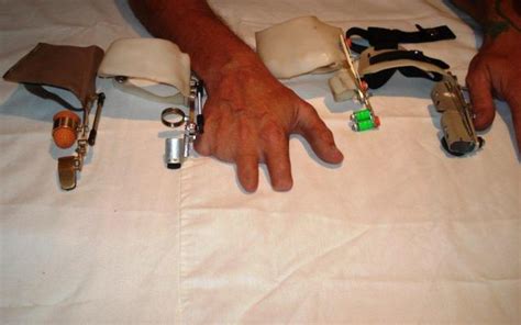 robohand open source hand prosthetic universal design style