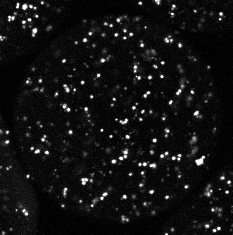 stardist 3d image artifact issue · issue 235 · henriqueslab