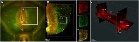 3d Rendering Of Kndy Neuron Projections In The Rat Hypothalamus