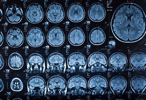 Our Services Radiance Diagnostics