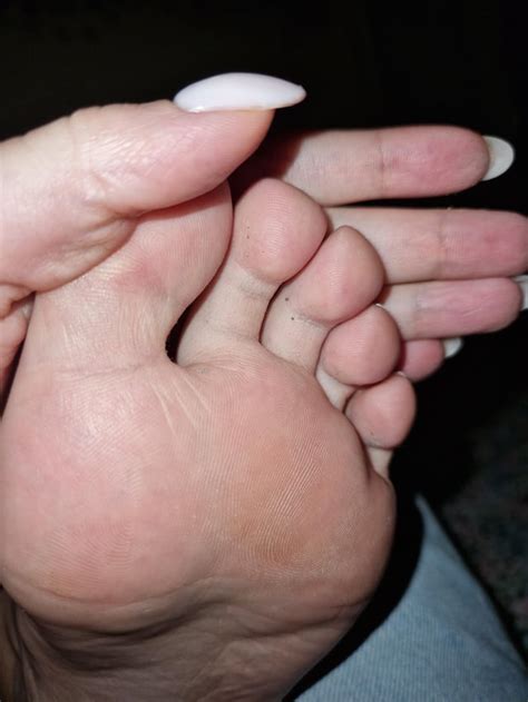 Can You See My Toejam R Toejamfeet